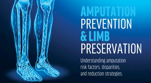 Amputation Prevention & Limb Preservation - Endovascular Today